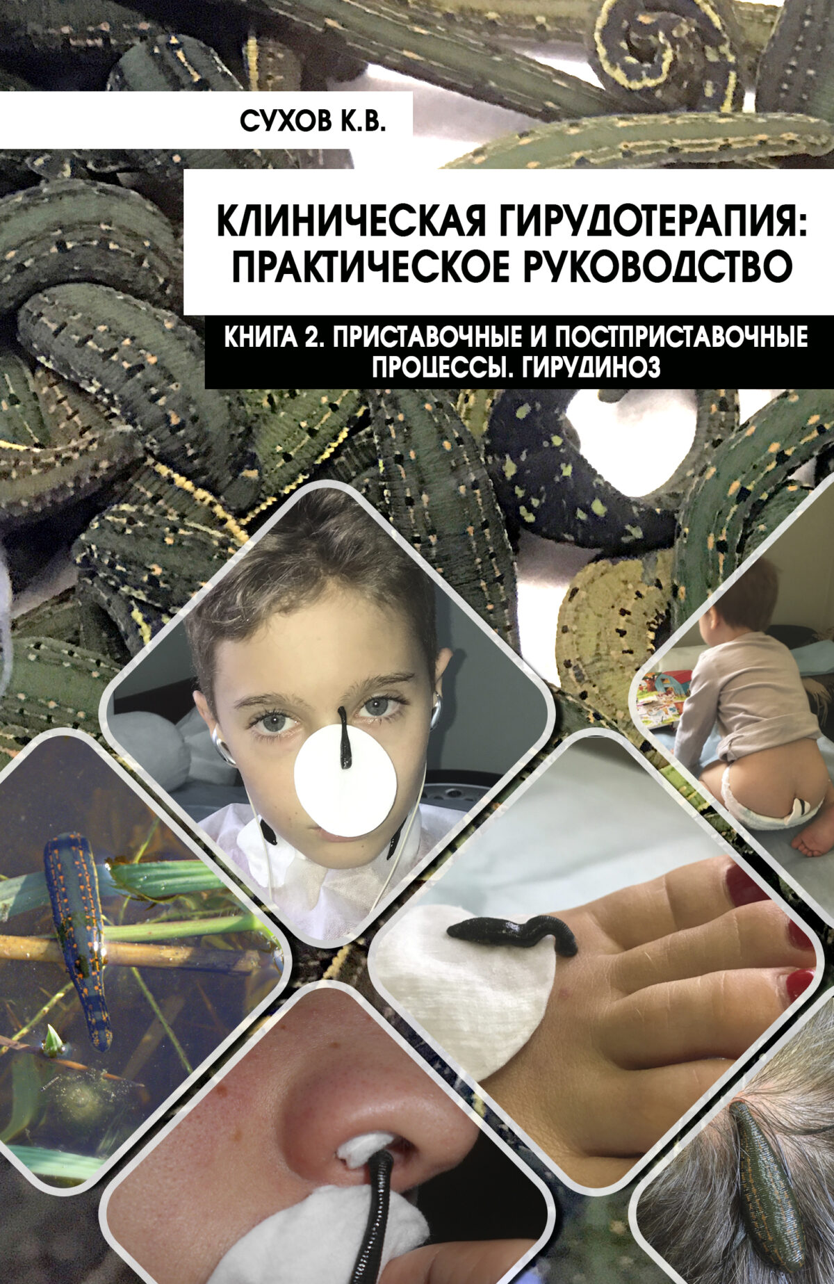 Literature | Third World Hirudotherapy Congress